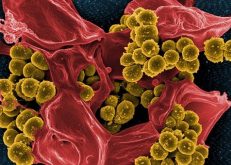 Microbes in the Tangle of Dementia - International Probiotics Association